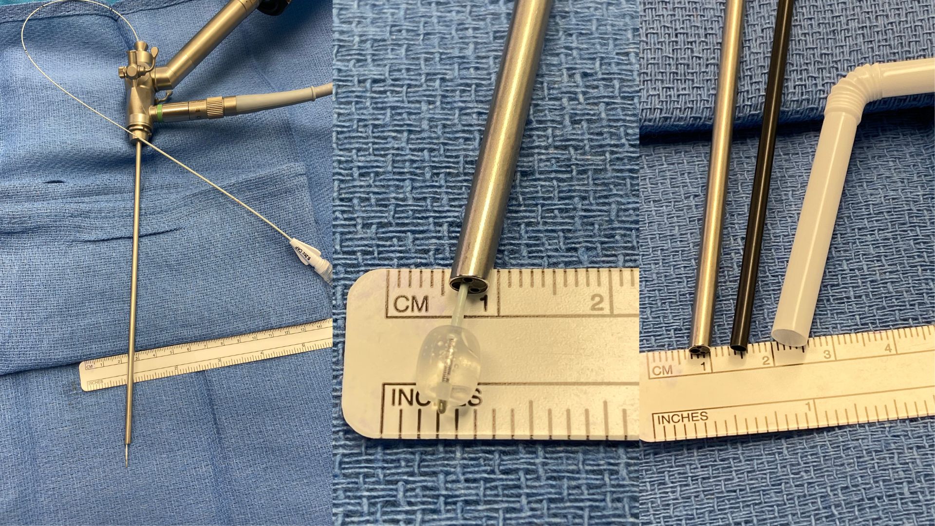 Brain Cysts - Taylor Family Department of Neurosurgery