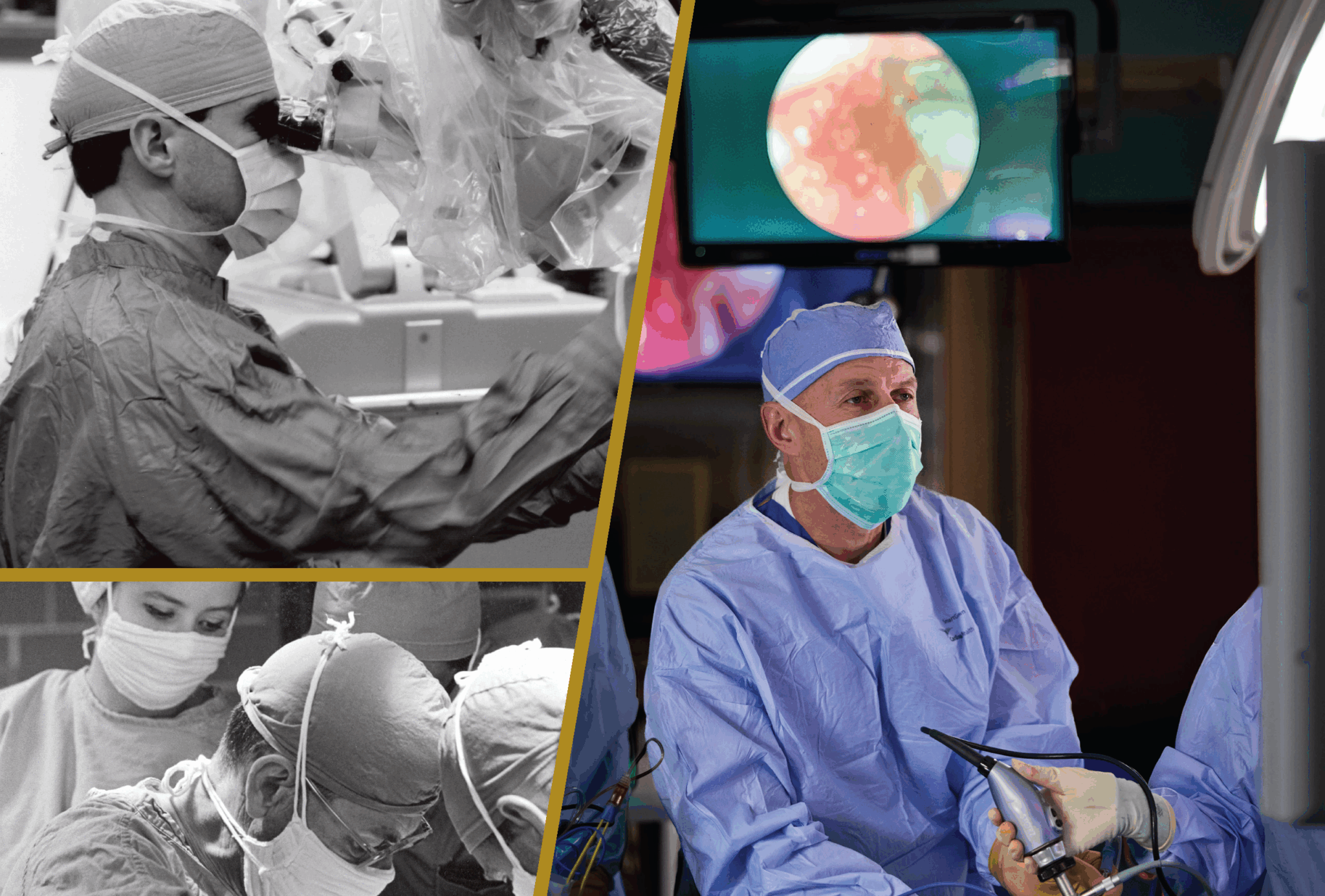 Neurosurgery - Taylor Family Department of Neurosurgery